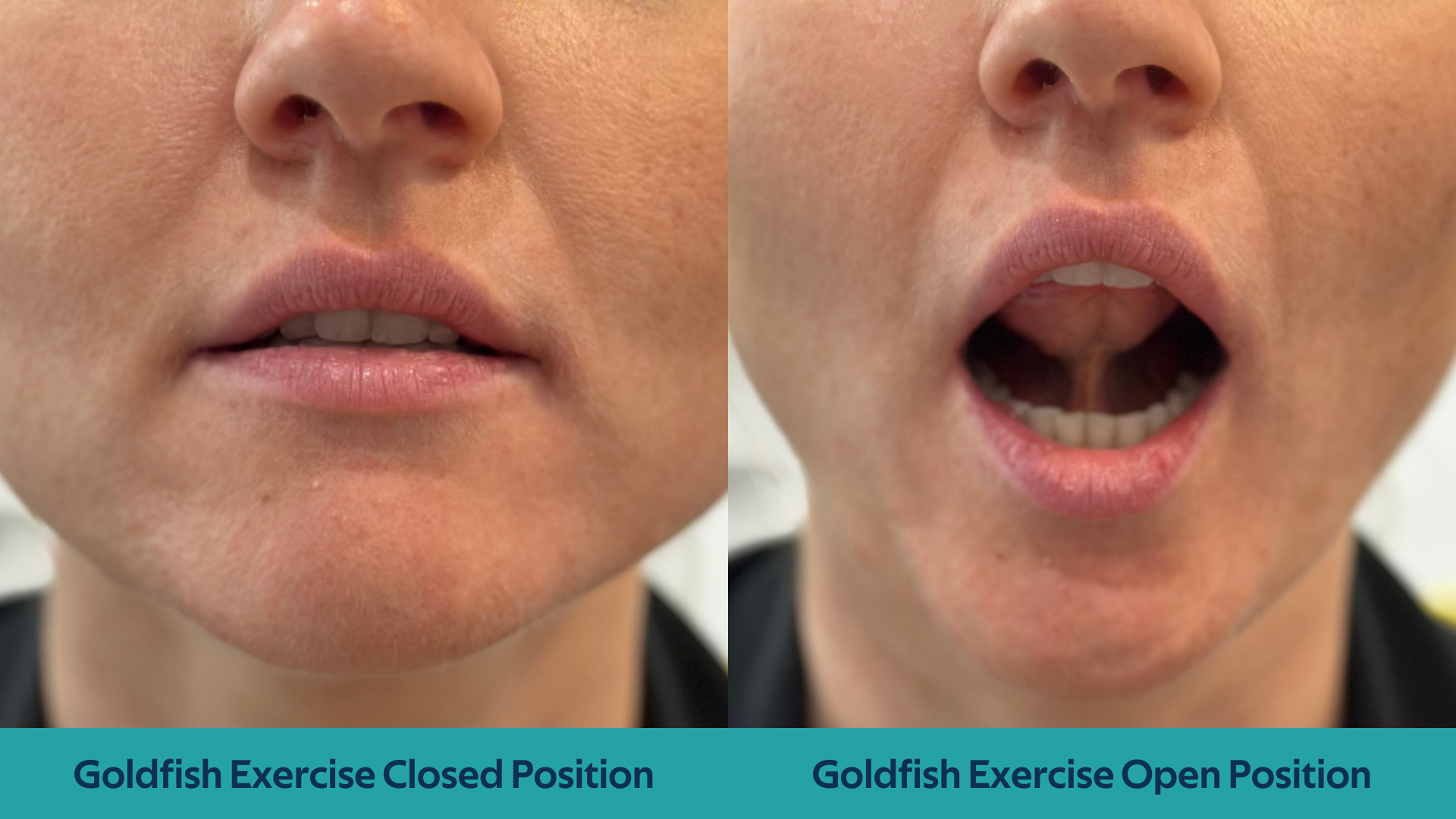 TMJ and Jaw Pain Remedies